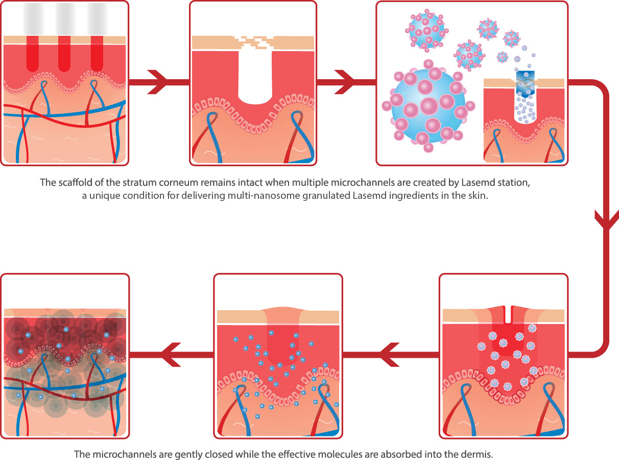 LaseMD Ampoules – Cynosure Lutronic Australia