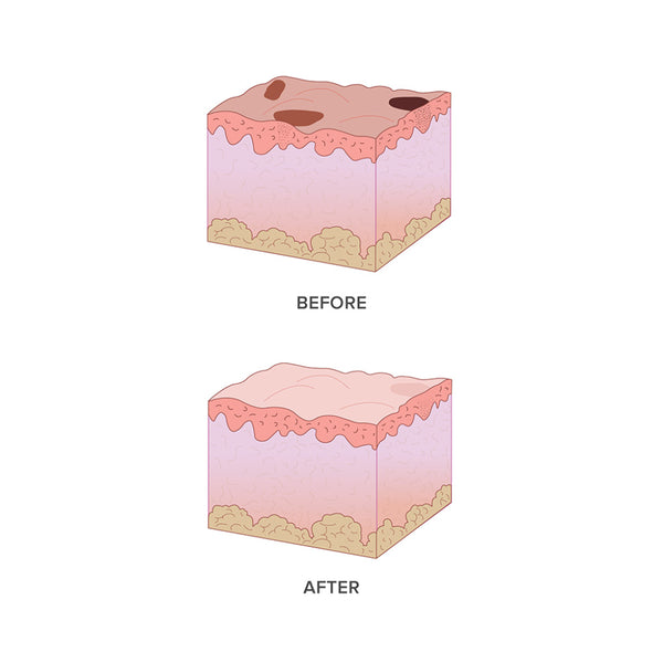 DermaV – Cynosure Lutronic Australia