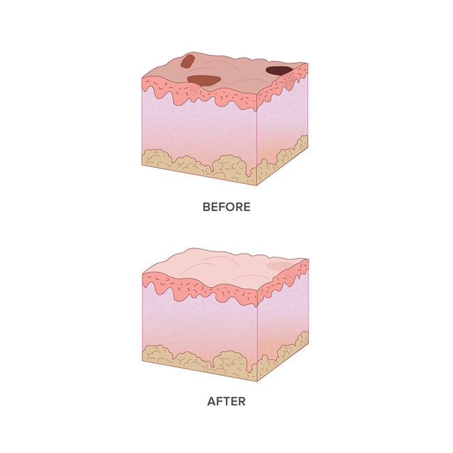 DermaV – Cynosure Lutronic Australia