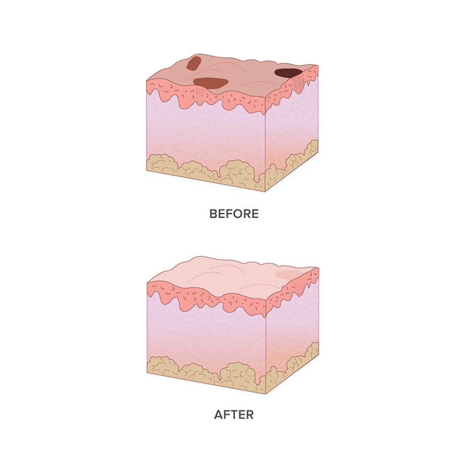 DermaV – Cynosure Lutronic Australia